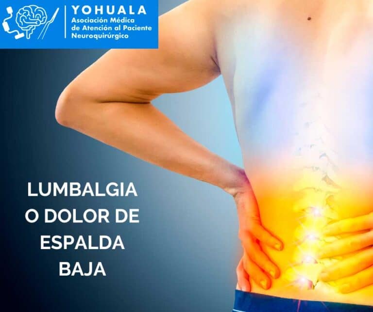 Lumbalgia | Neurocirujano en Cuernavaca