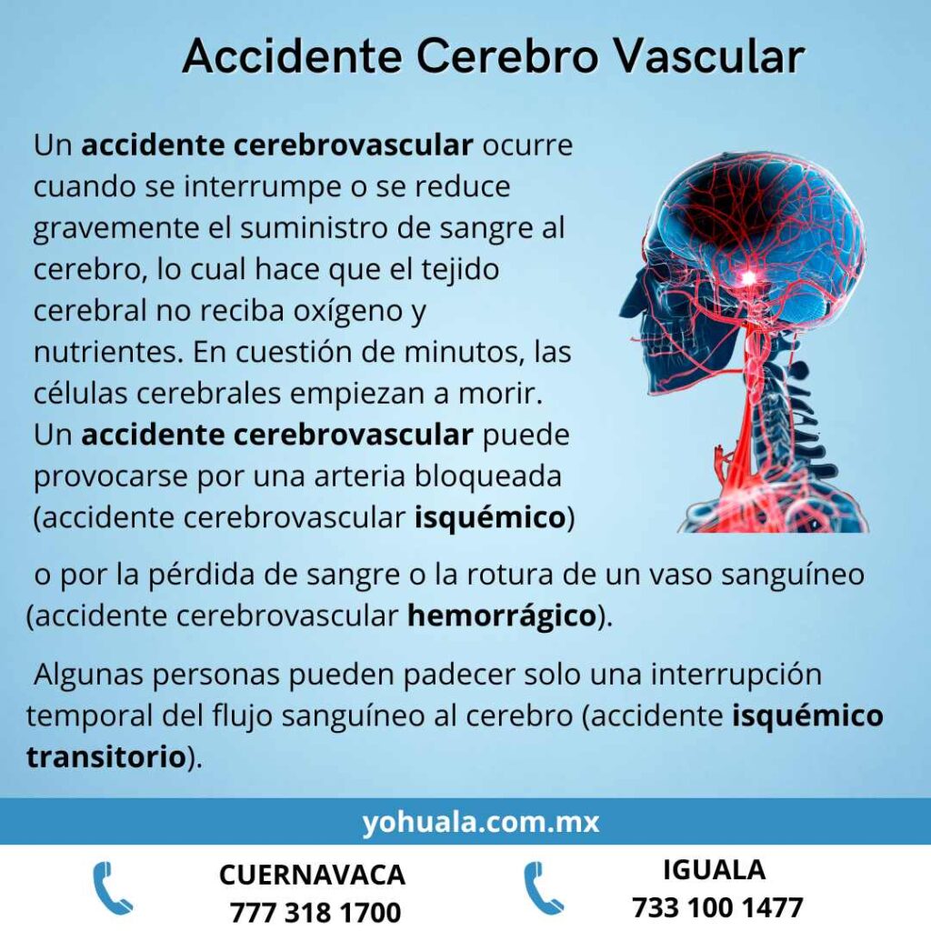 Accidente Cerebrovascular (ACV) | Neurocirujano en Cuernavaca